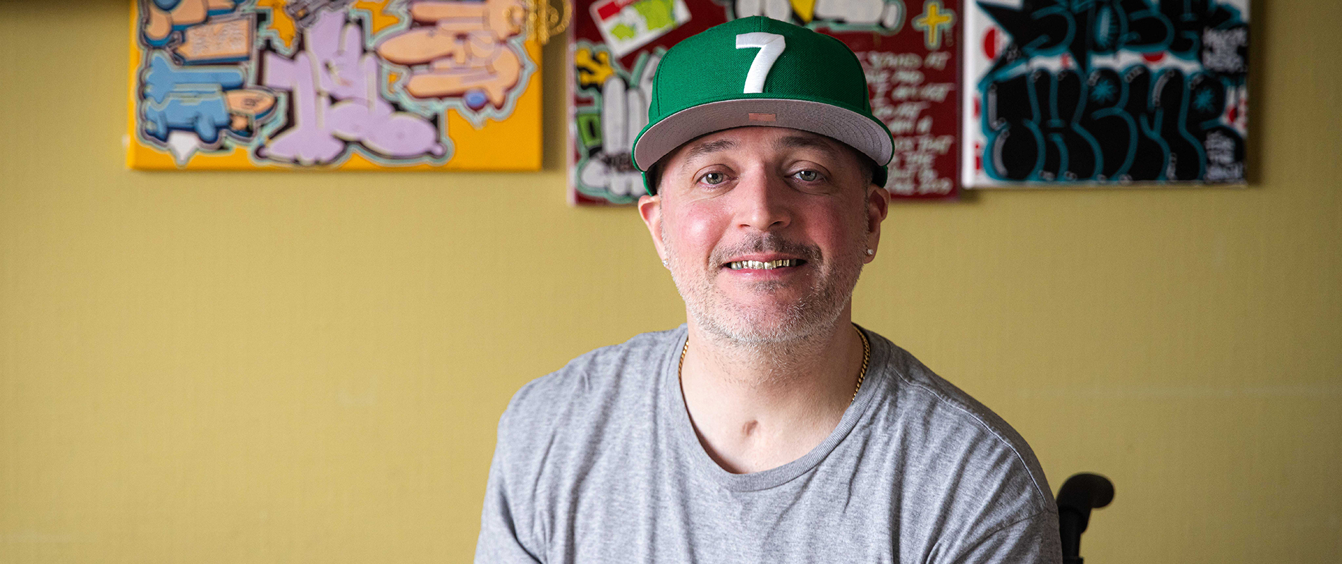 Resurrecting Harry's Hand - NYC Health + Hospitals